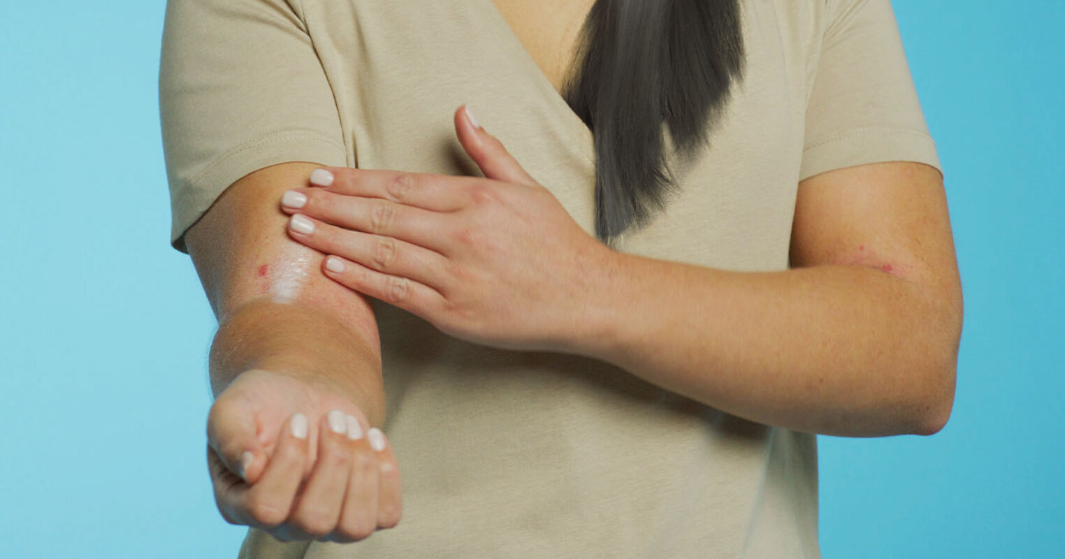 What Is Eczema & Care Tips: A Beginner’s Guide | Cetaphil HK